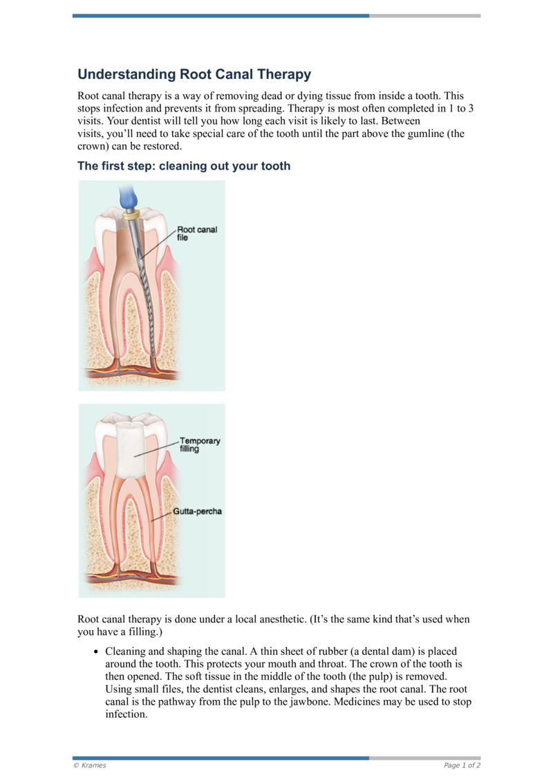 PDF - Understanding Root Canal Therapy - HealthClips Online