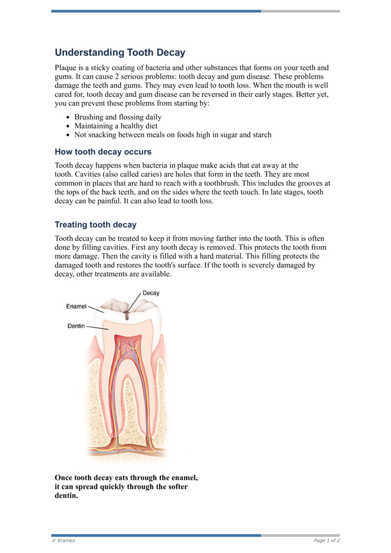 Text - Understanding Tooth Decay - HealthClips Online