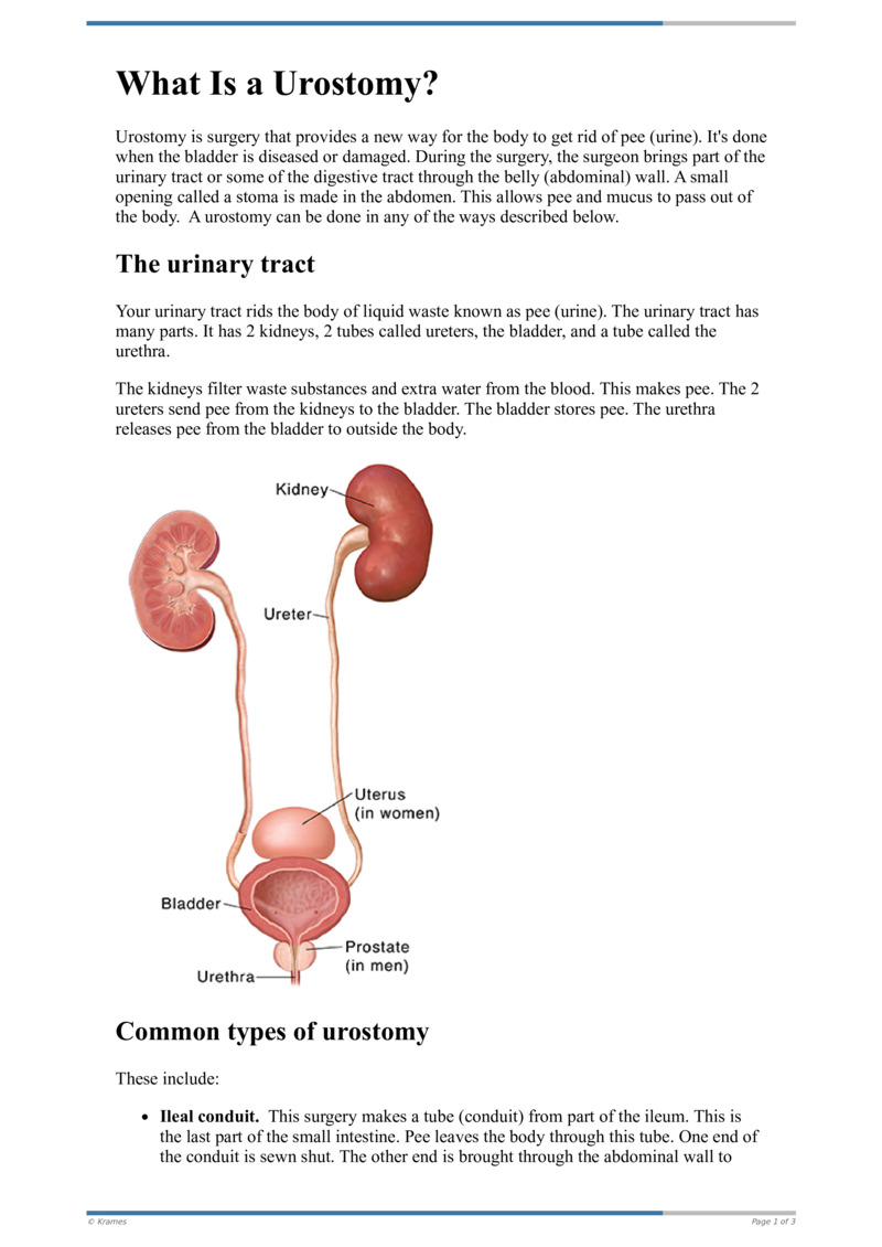 Text - What Is a Urostomy? - HealthClips Online