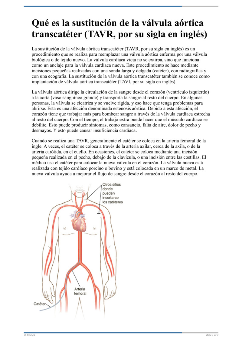 Text - Qué es la sustitución de la válvula aórtica transcatéter (TAVR ...