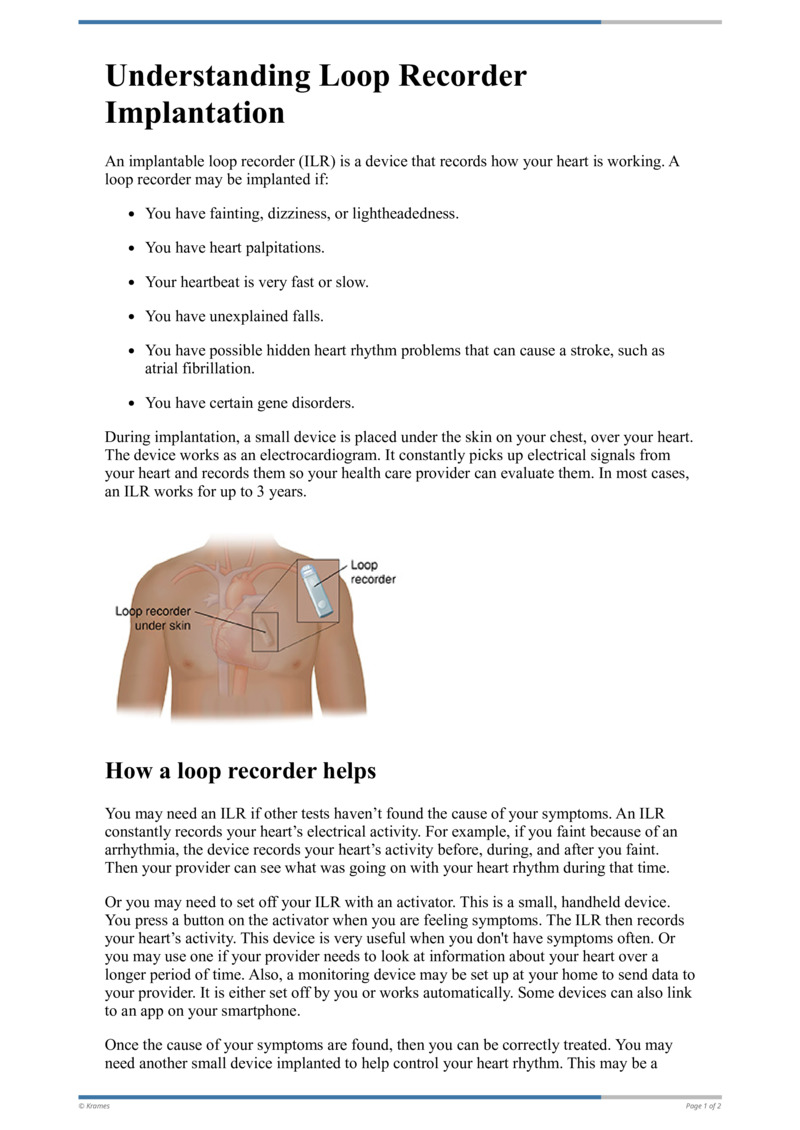 Text Understanding Loop Recorder Implantation HealthClips Online Text Understanding Loop Recorder Implantation HealthClips Online