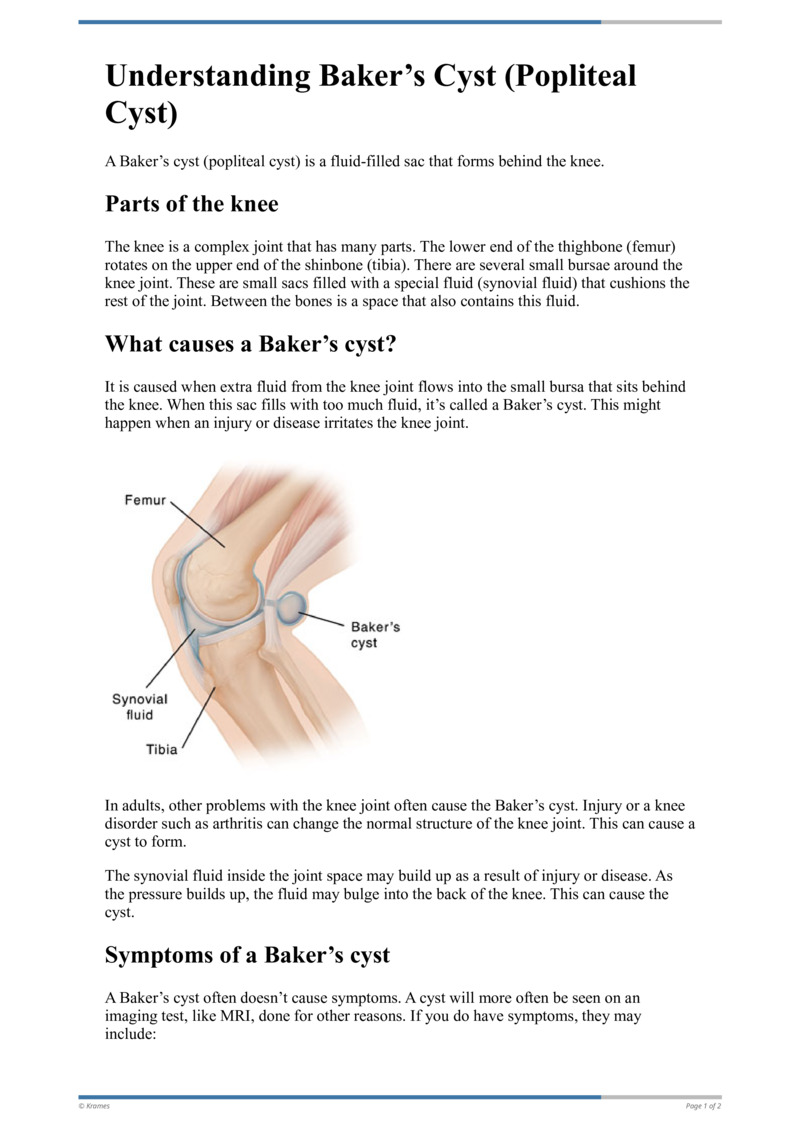 Text - Understanding Baker's Cyst (Popliteal Cyst) - HealthClips Online