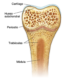 Texto - ¿Qué es un hematoma óseo (contusión ósea)? - HealthClips Online