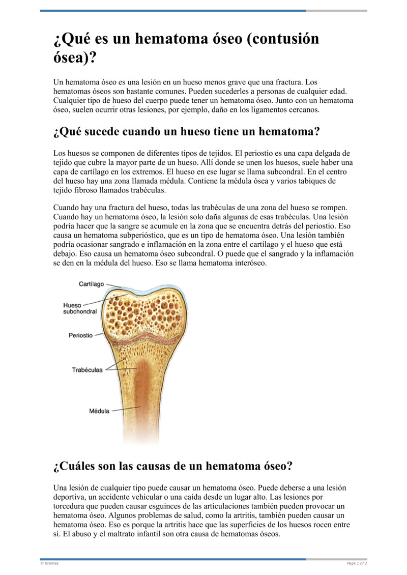 Text - ¿Qué es un hematoma óseo (contusión ósea)? - HealthClips Online