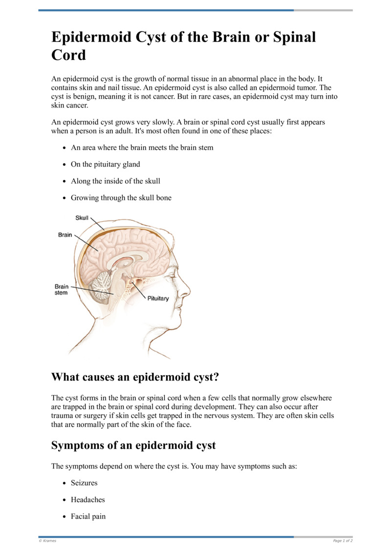 Text - Epidermoid Cyst of the Brain or Spinal Cord - HealthClips Online