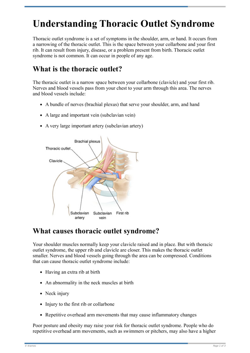 Text - Understanding Thoracic Outlet Syndrome - HealthClips Online
