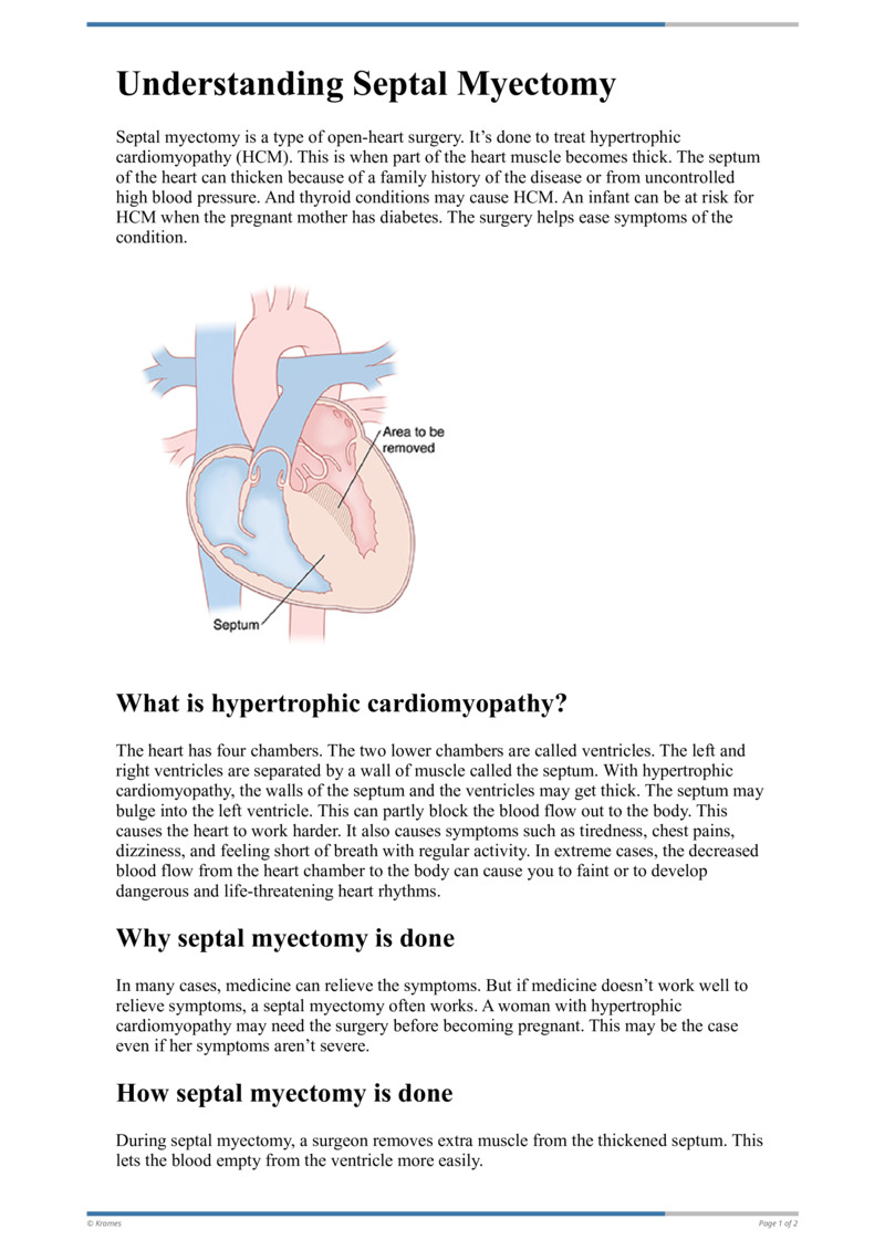Text - Understanding Septal Myectomy - HealthClips Online