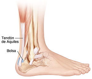 Anatomía De La Bursitis Del Talón Bursitis Retrocalcanea