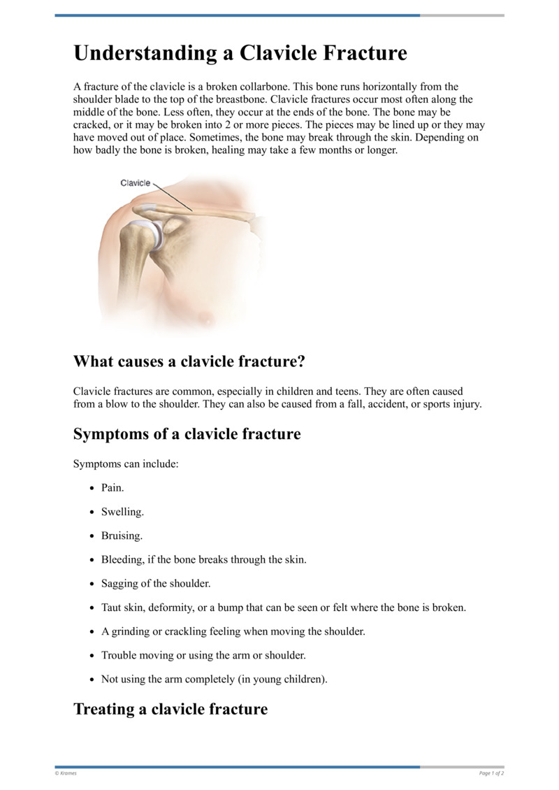 Clavicle Fractures Dr Michael Codsi Patient Education Partial Rotator