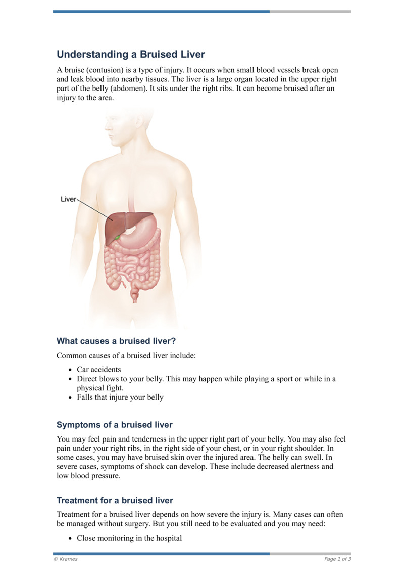 PDF - Understanding a Bruised Liver - HealthClips Online