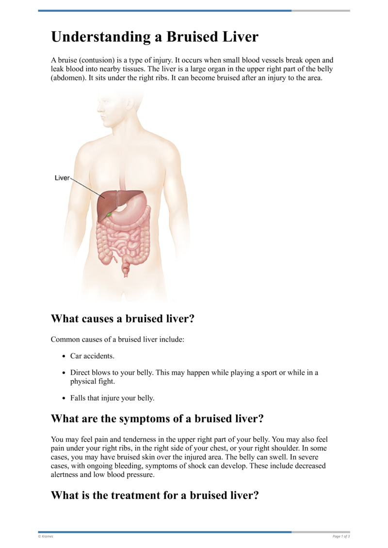 Text - Understanding a Bruised Liver - HealthClips Online