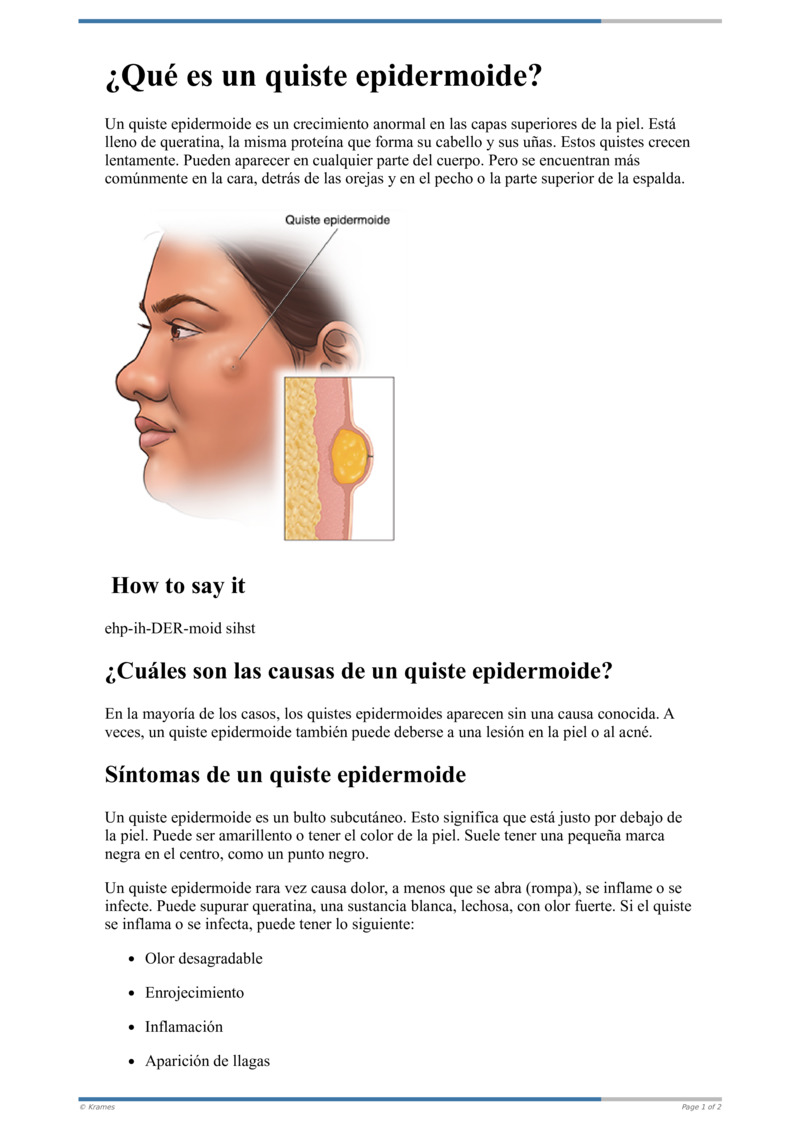 Text - ¿ Qué es un quiste epidermoide? - HealthClips Online