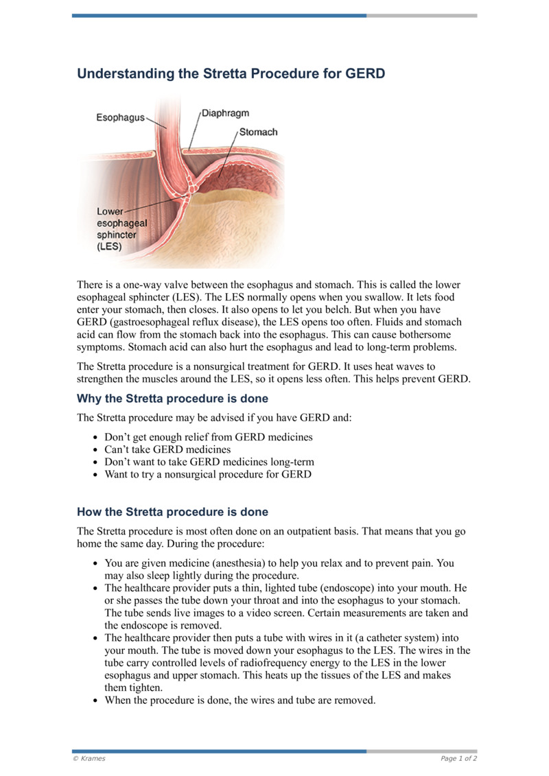 PDF - Understanding the Stretta Procedure for GERD - HealthClips Online