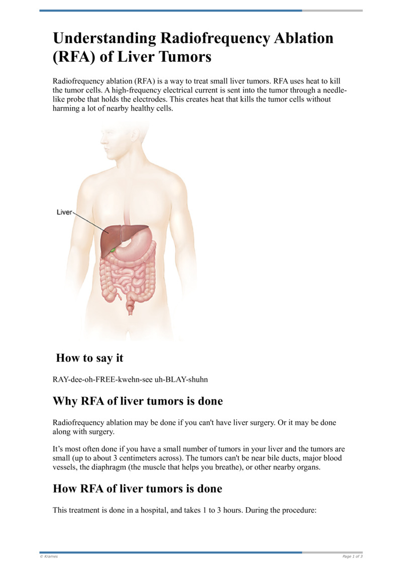 Text - Understanding Radiofrequency Ablation (RFA) of Liver Tumors ...