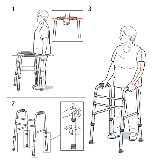 Text - Step-by-Step: Fitting a Walker - HealthClips Online
