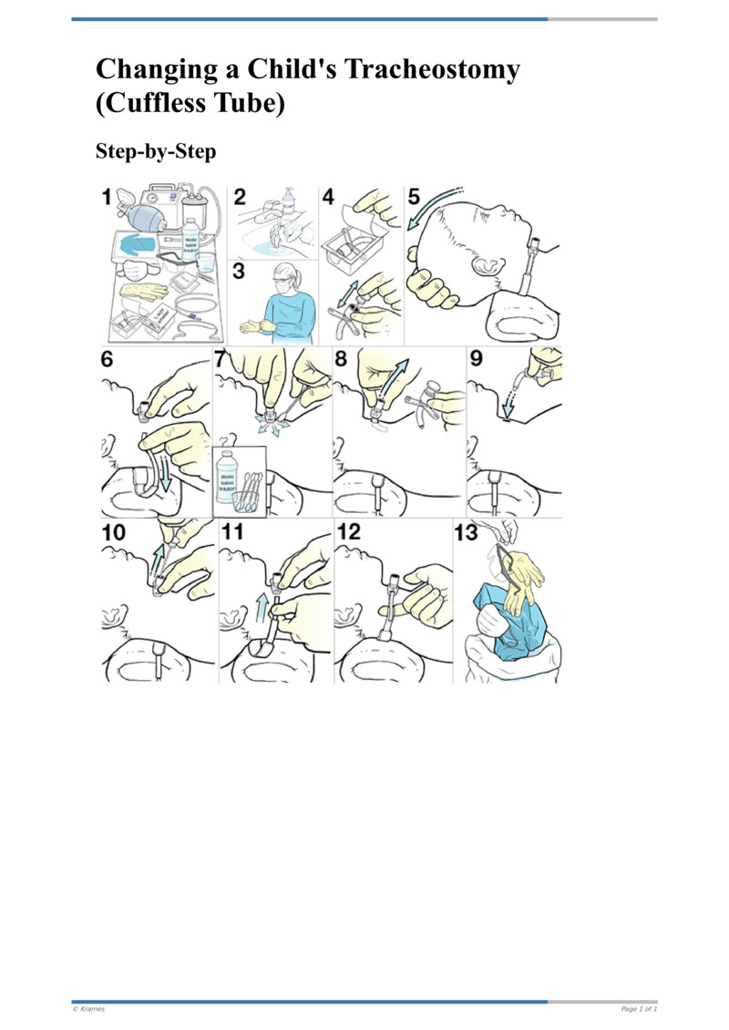 Text - Step-by-Step: Changing a Child's Tracheostomy - HealthClips Online