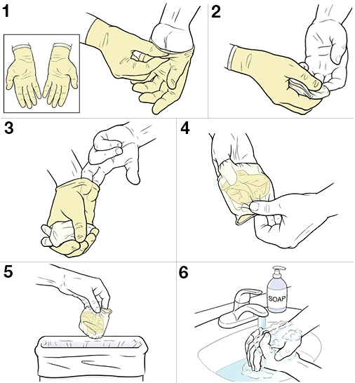 Text - Step-by-Step: Sterile Technique for Taking Off Gloves ...