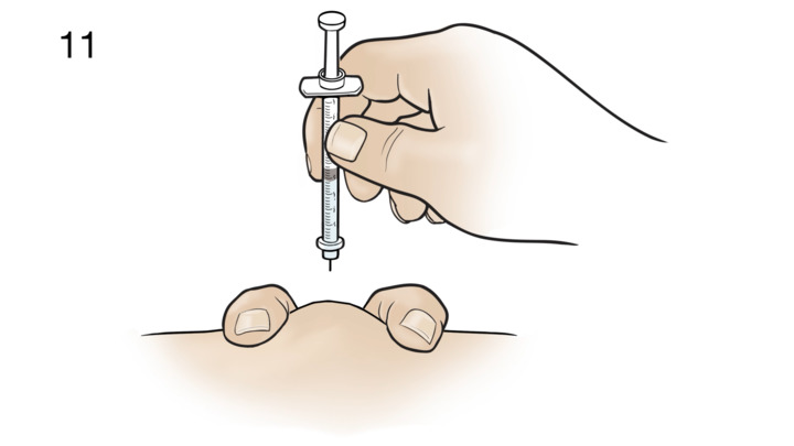 Video - Step-by-Step: Giving Yourself a Shot - HealthClips Online