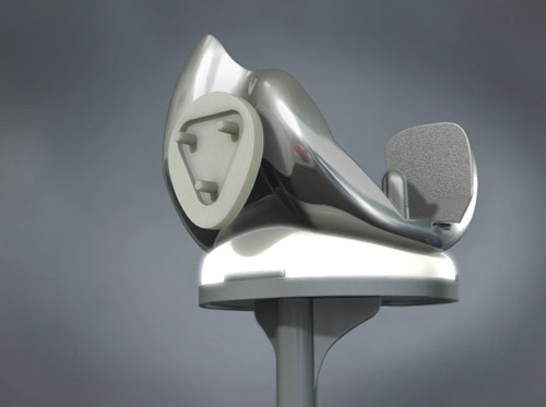 Video - Total Knee Replacement - HealthClips Online