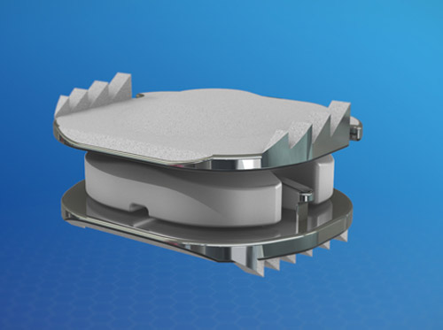 Video - Artificial Cervical Disc Replacement (Mobi-C®) - HealthClips Online