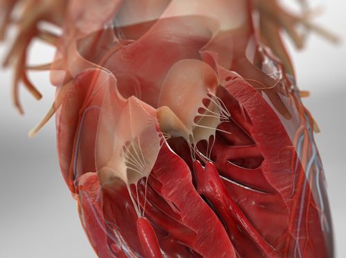 Video - Atrial Septal Defect (ASD) - HealthClips Online