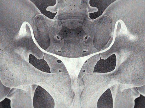 Video - Hysterosalpingography (HSG) - HealthClips Online