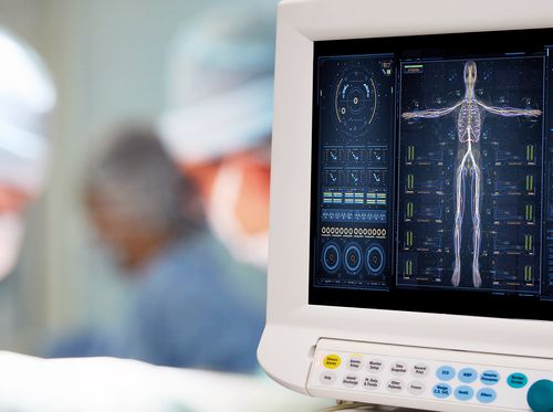 Video - Intraoperative Neurophysiologic Monitoring (IONM; IOM ...