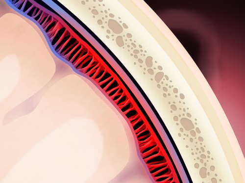 Video - Meningitis - HealthClips Online