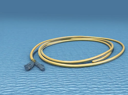 Video - Nasogastric (NG) Tube: Overview - HealthClips Online