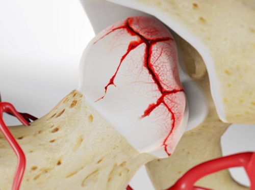 Video - Legg-Calve-Perthes Disease (LCPD) - HealthClips Online