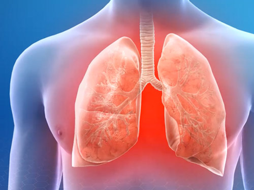 Video - Pneumonia: Treatment - HealthClips Online