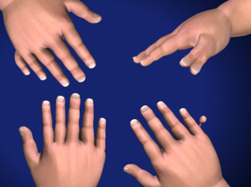 Video - Polidactilia de la mano - HealthClips Online