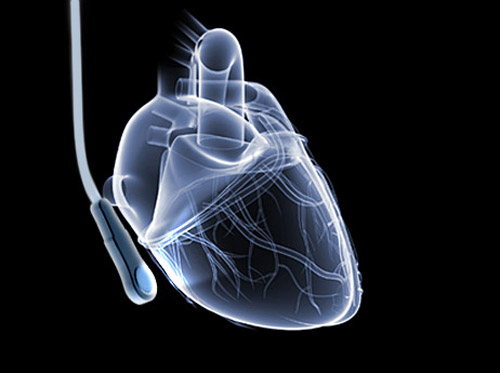 Video - Transesophageal Echocardiography (TEE) - HealthClips Online