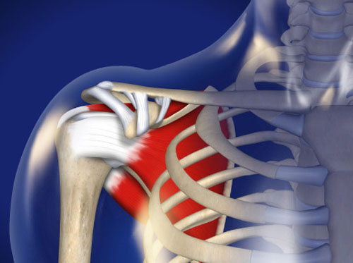 Video - Ultrasound-Guided Injection for Shoulder Pain - HealthClips Online