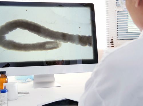Video - Tapeworm Infection - HealthClips Online