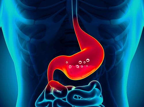 Video - Excess Intestinal Gas - HealthClips Online